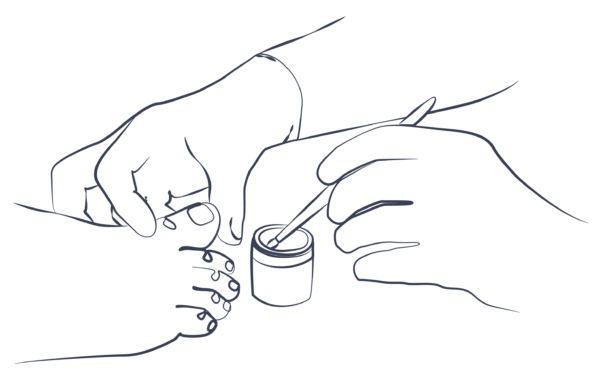 #1 Expert Toenail Reconstruction London - Chelsea Pedicure